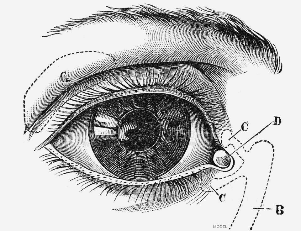 Tearing And Watery Eye Treatment Chicago Oculofacial Consultants
