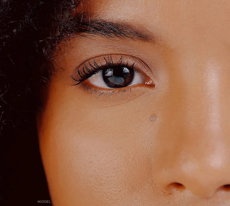 Trichiasis Treatment | Chicago Oculofacial Consultants