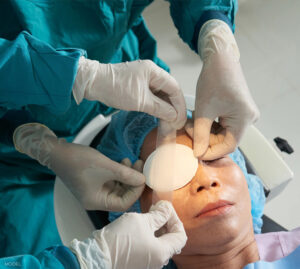 Enucleation | Chicago Oculofacial Consultants